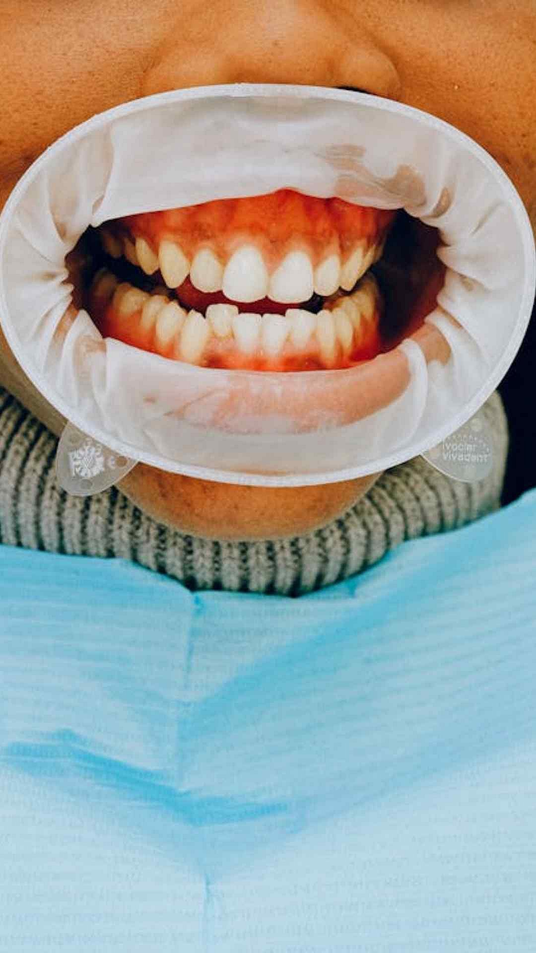 Teeth Health: घाणेरडे दात का किडू लागतात? | Teeth Health Why do dirty ...