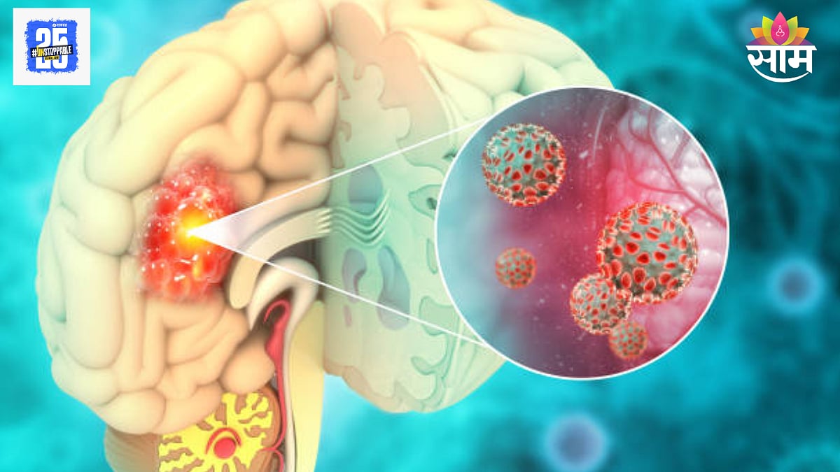 Early symptoms of brain cancer: मेंदूचा कॅन्सर होण्यापूर्वी शरीरात ...