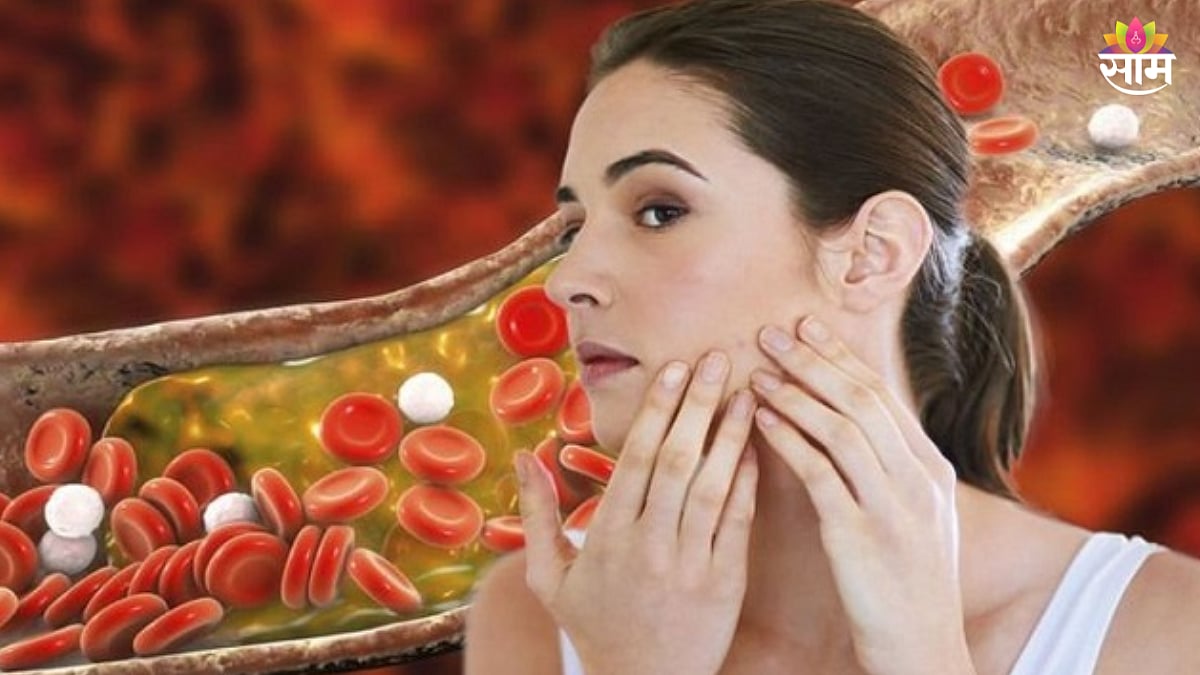 Cholesterol symptoms on face: शरीरात कोलेस्ट्रॉल वाढल्यावर चेहऱ्यावर ...