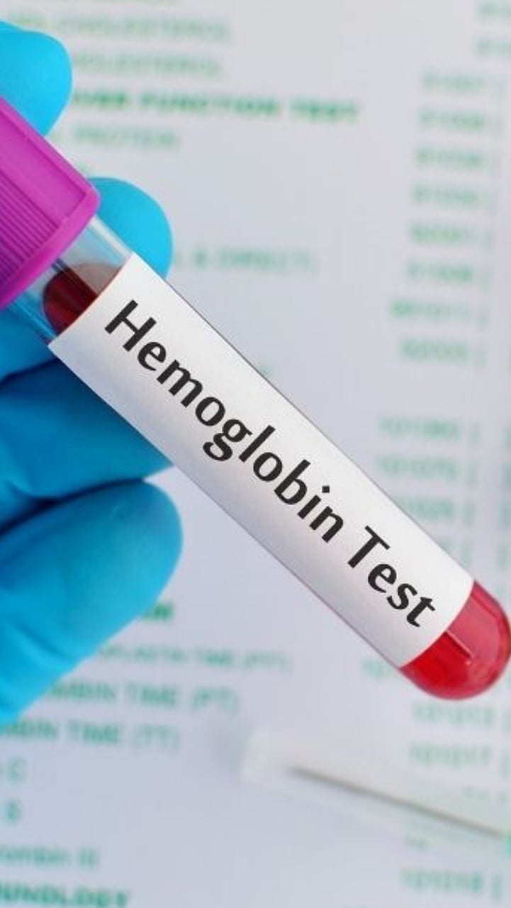 Hemoglobin levels: तुमच्या वयानुसार तुमचं हिमोग्लोबिन किती असलं पाहिजे ...