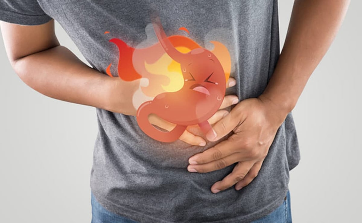 12 Best Homemade Remedies For Acidity: Natural Solutions To Get Rid Of ...