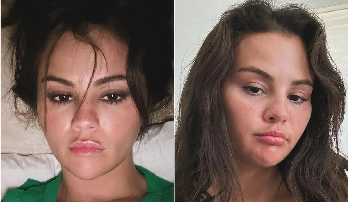 Selena Gomez Addresses Cosmetic Surgery Rumors, Clarifies Botox Use ...