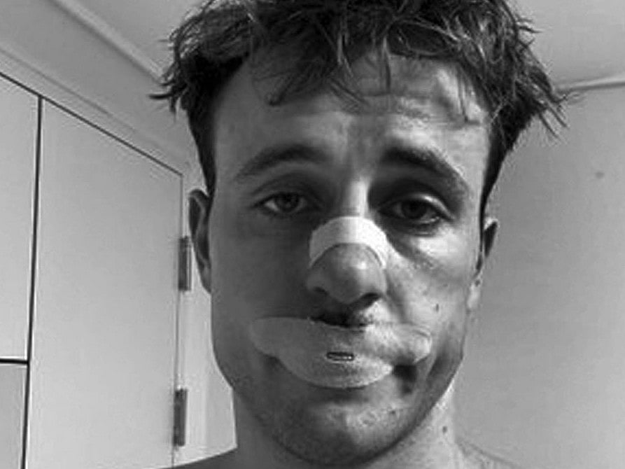 ‘social Media Fad Of Mouth Taping During Sleep May Pose Serious Risks 8761