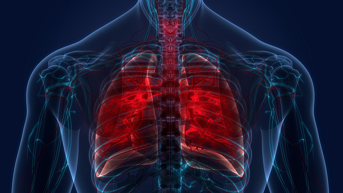 Tuberculosis (TB) Screening and Awareness Drive Intensified Across ...
