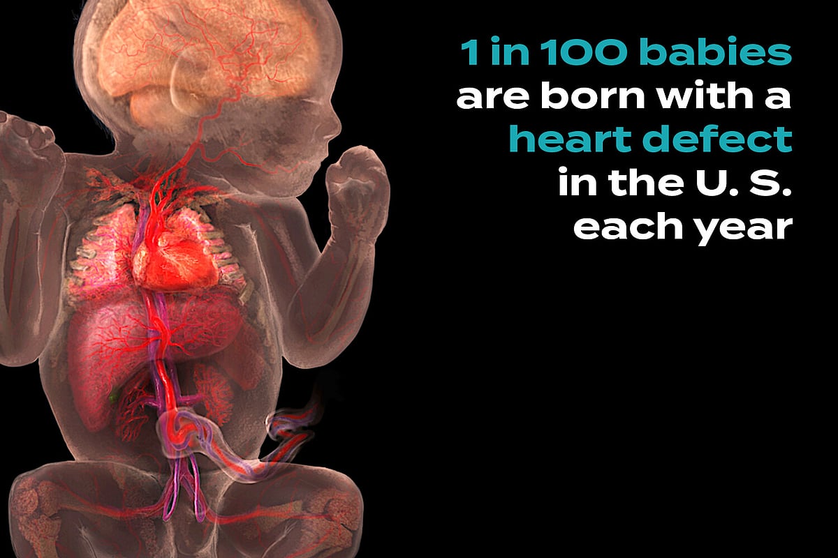 Congenital Heart Defects in Babies: A Tiny Heart, a Big Impact