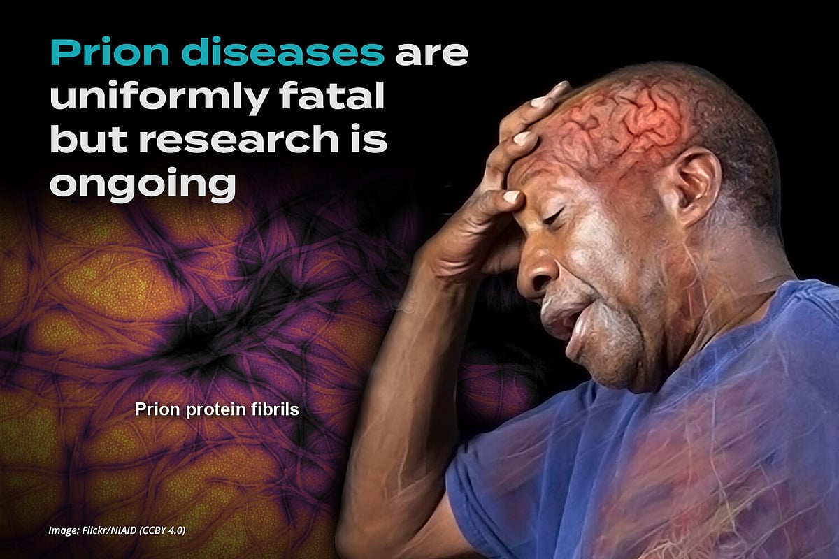 This Devastating Disease Turns Your Brain Into a Sponge