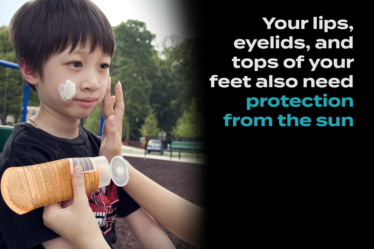 What Can We Learn from the Aussies About Protecting our Skin from the Sun?