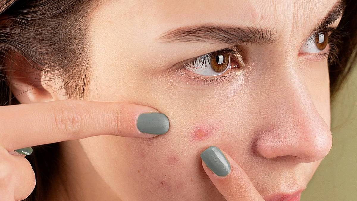 7 Common Skin Issues: Causes, Symptoms, and Treatments