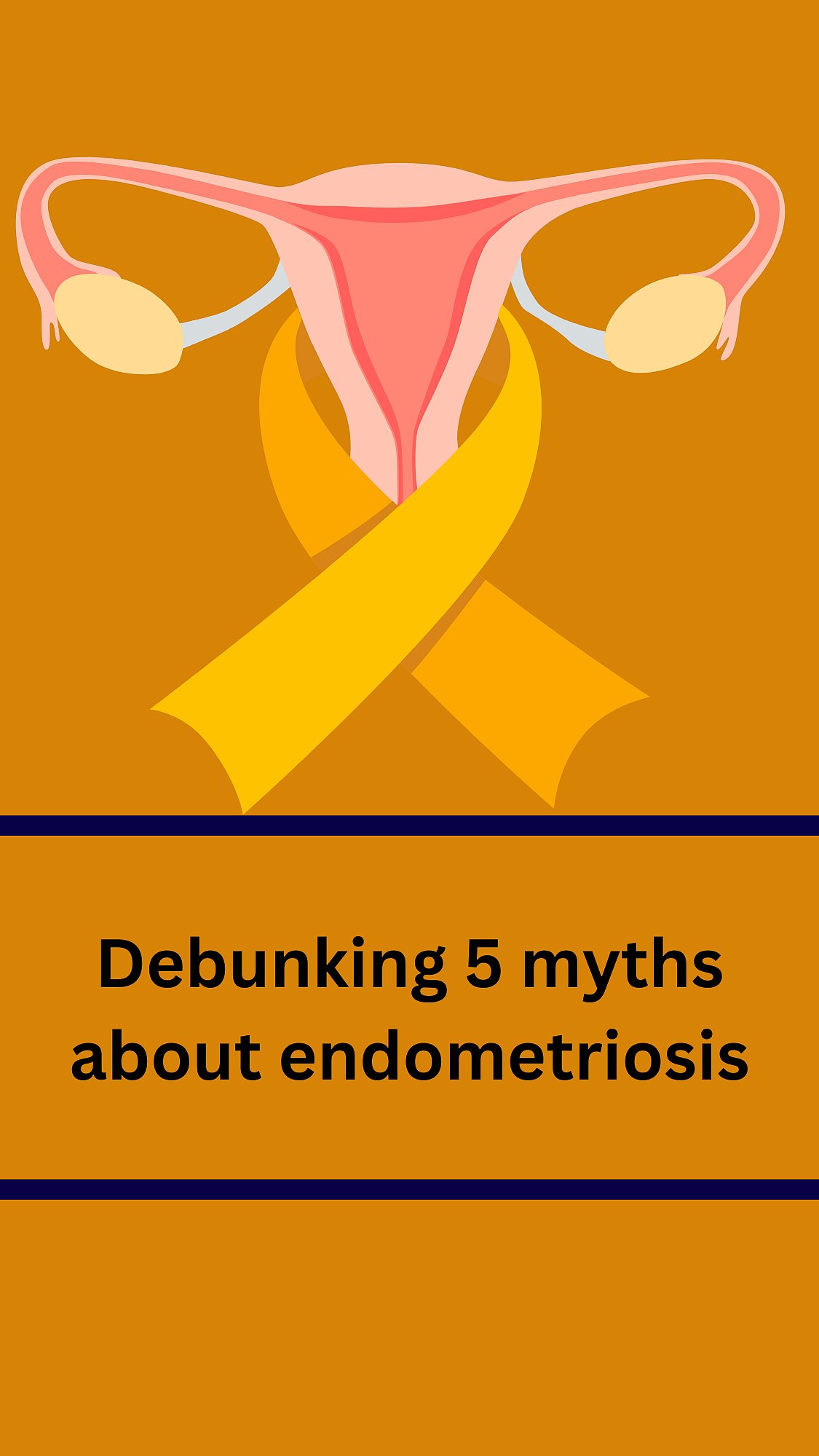 Debunking 5 myths about endometriosis