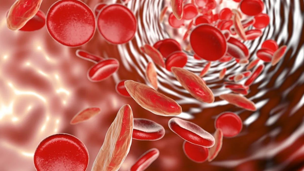 Study finds Vitamin B12 deficiency, air pollution also major causes of ...