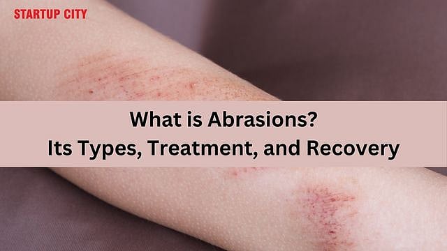 What is Abrasions?