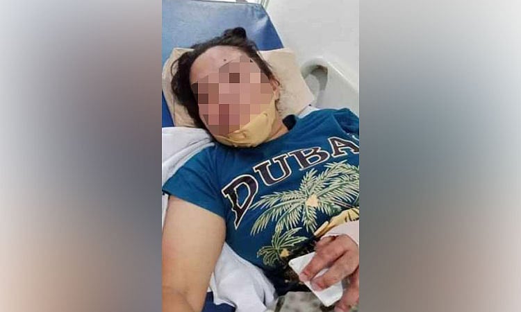 Motorsiklo mibangga sa poste: 1 patay, 1 angol