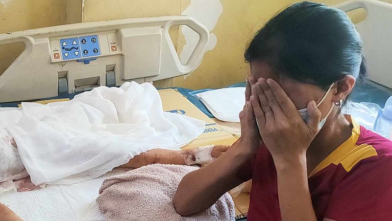2-year-old child seriously injured after dog attack in Samar