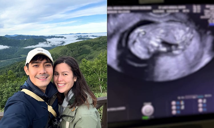 Robi Domingo, wife are expecting their first child