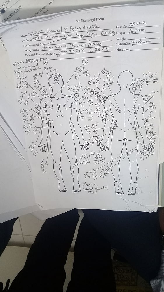 NBI says operation vs Adonis Dumpit not an overkill