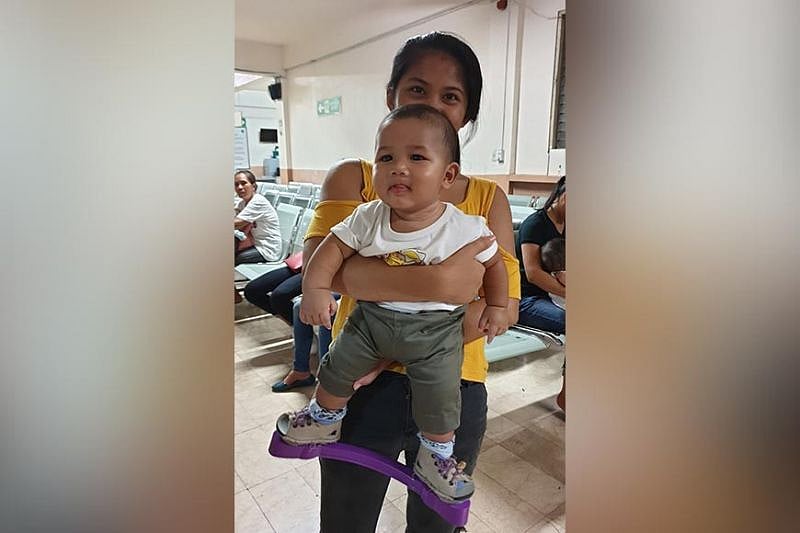 World Clubfoot Day: There's hope for babies