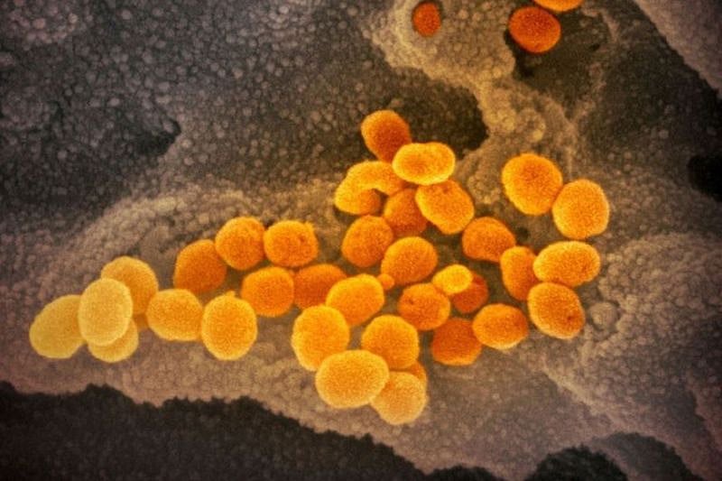 Coronavirus airborne only in confined hospital settings, DOH assures