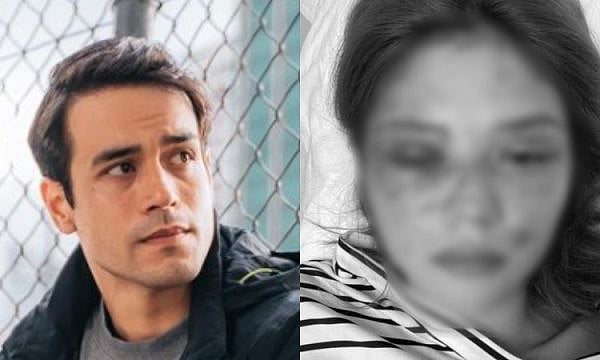 Charges filed vs actor Kit Thompson for allegedly beating girlfriend