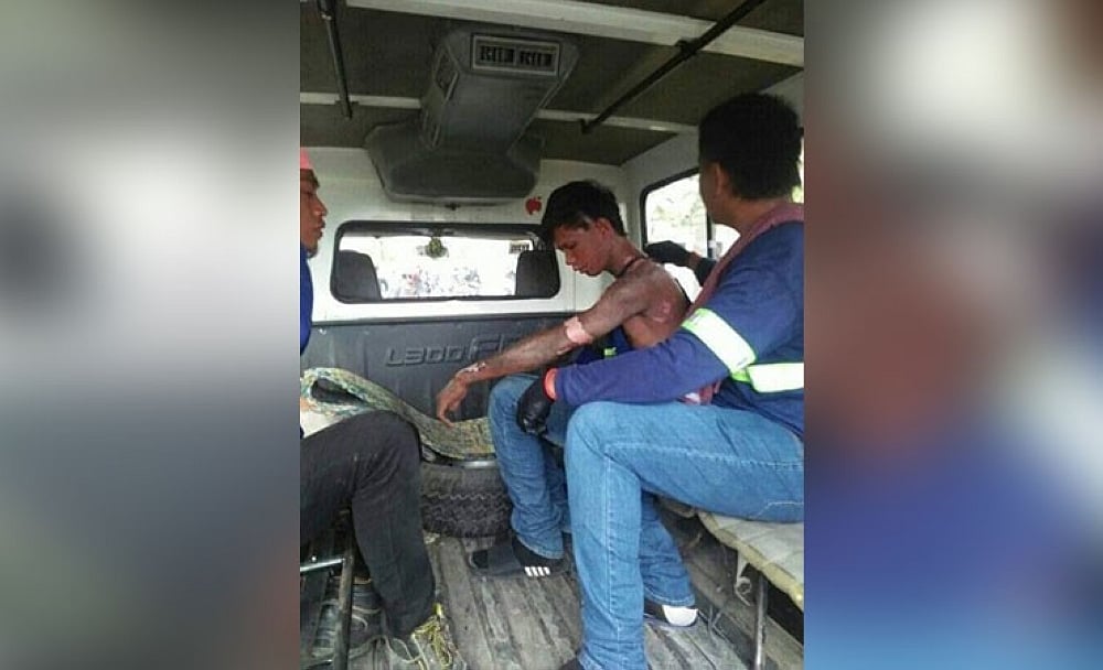 Napaso-paso sa kuryente, dakong buhi