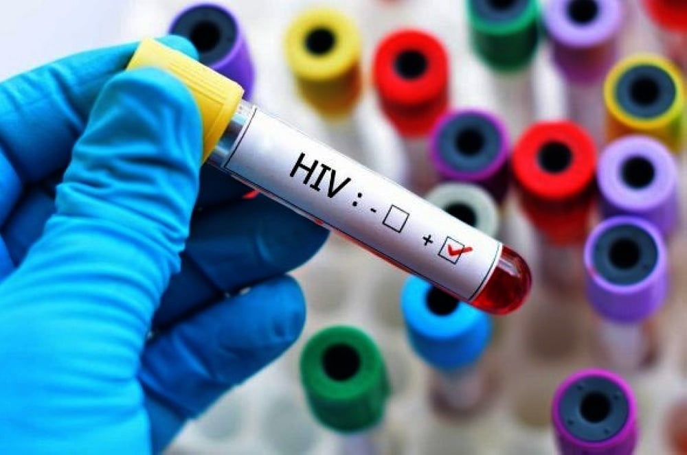 396 new HIV-Aids cases in Davao City recorded from January to September ...