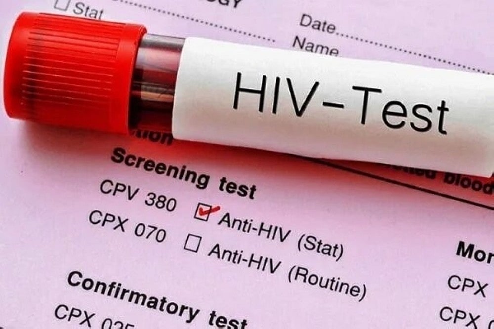 Philippines' HIV cases to triple by 2030