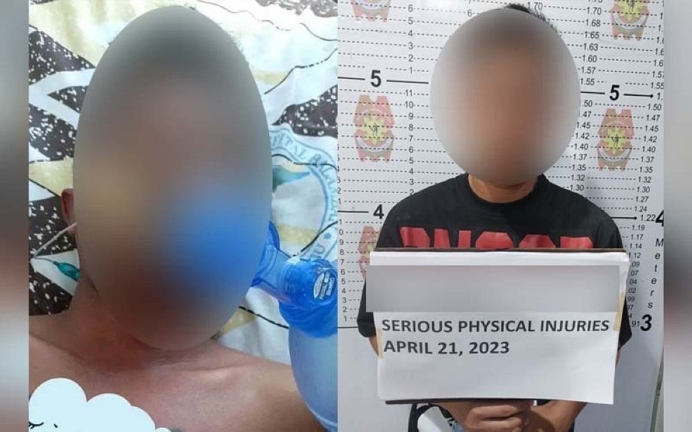 23 anyos 'gikulata', patay