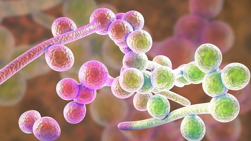 Needs help for yeast infection (Part 2)