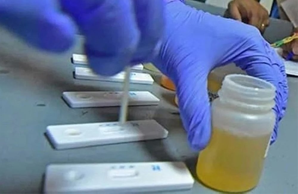 DILG to conduct random, surprise drug tests among agencies, LGUs