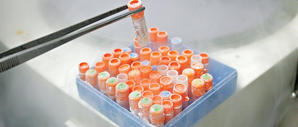 Govt hospitals to offer free lab tests, CT scan