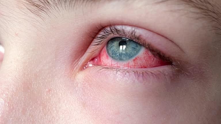 How Bacteria Spread to the Eyes and Ears: Causes and Prevention