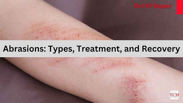 Abrasions: Types, Treatment, and Recovery