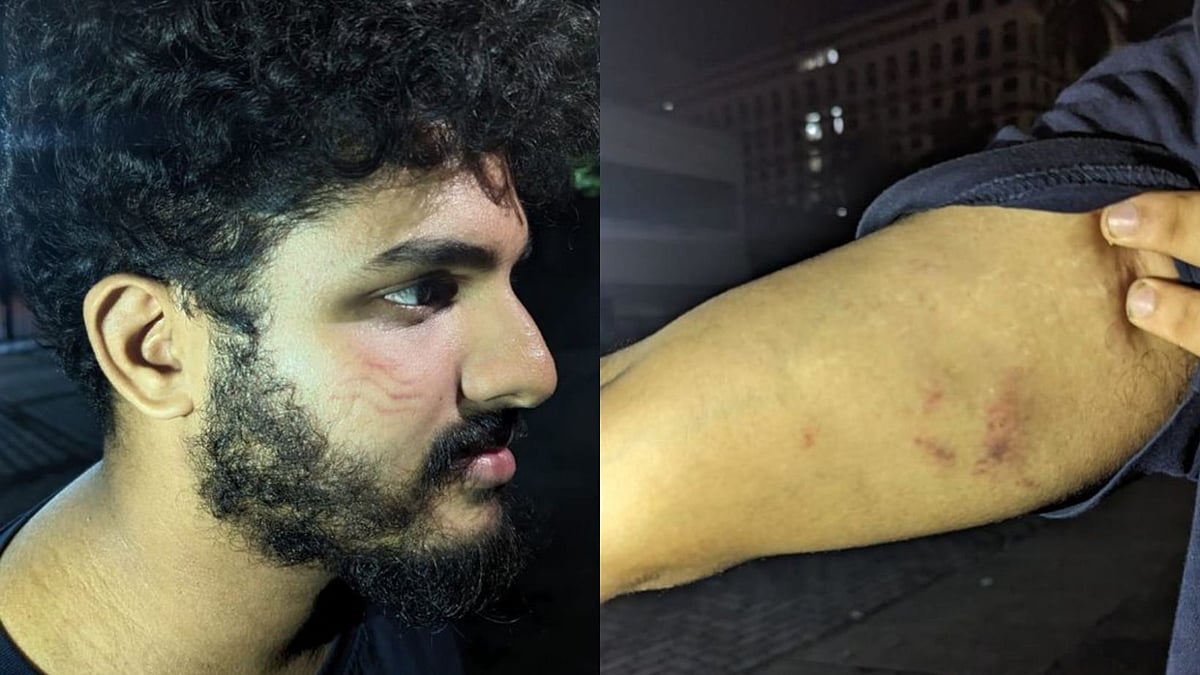 CPI(M) members attack journalist, friend who staged protest at Nava ...