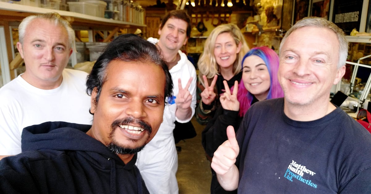 matthew smith prosthetics