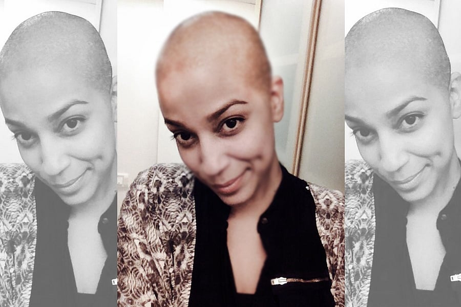 Bald and Beautiful by Choice