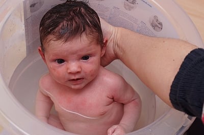 Cause of disease that turns babies' lips blue identified