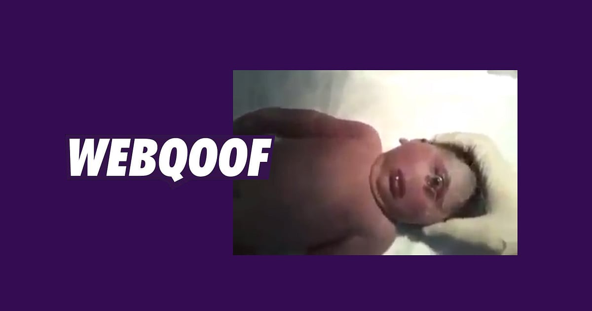 One Eye Dajjal Baby Born in Israel Viral Video Fact Check: Old Video of ...