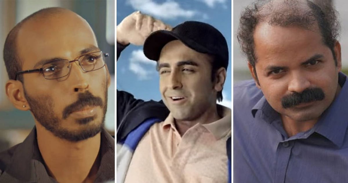 Bala Movie: Before Ayushmann Khurrana-Starrer ‘Bala’ Releases, Here Are ...