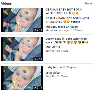 Person Born With Three Eyes