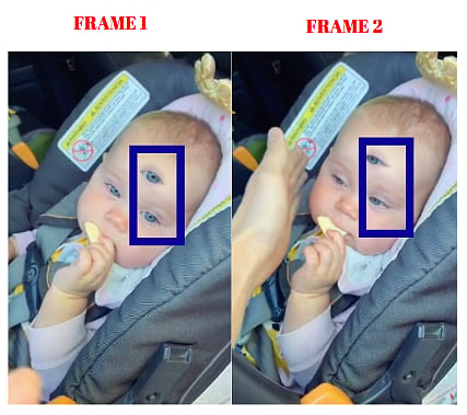 People Born With Three Eyes