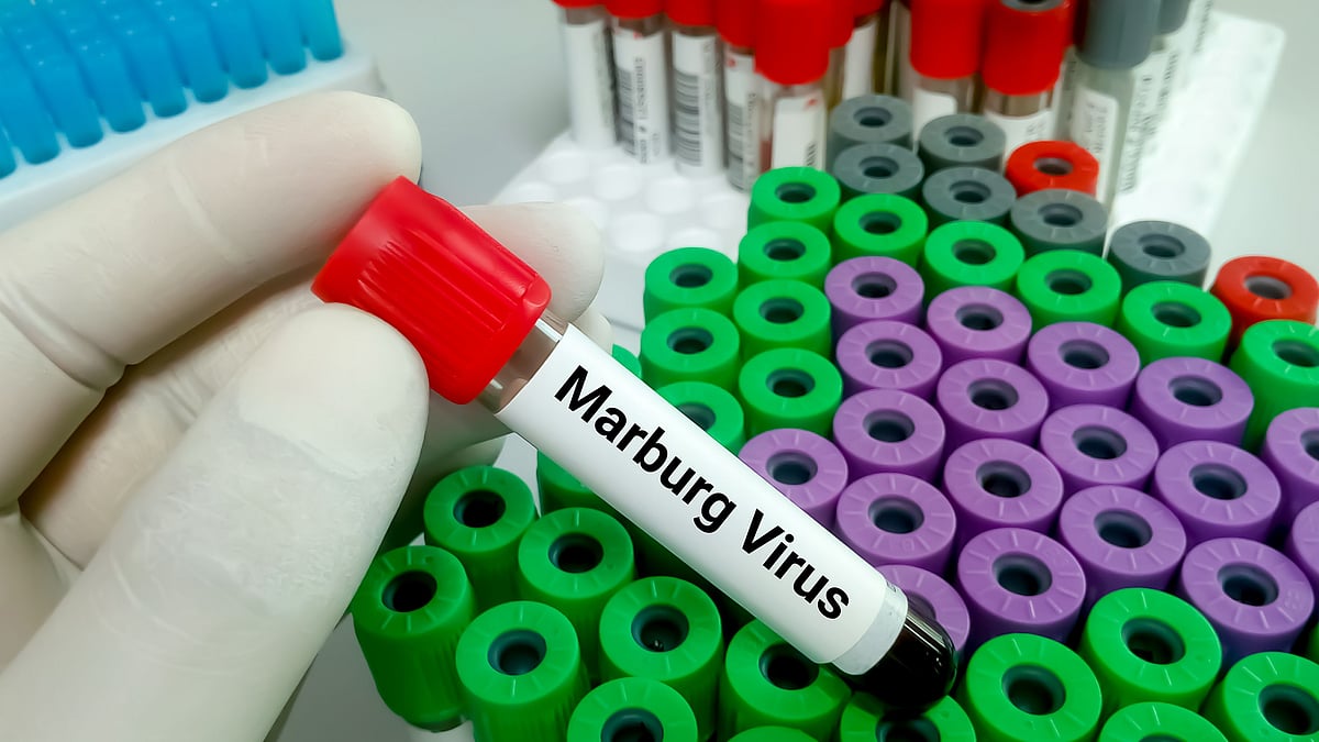 What Is Marburg Disease? Symptoms, Causes, and Treatment Options