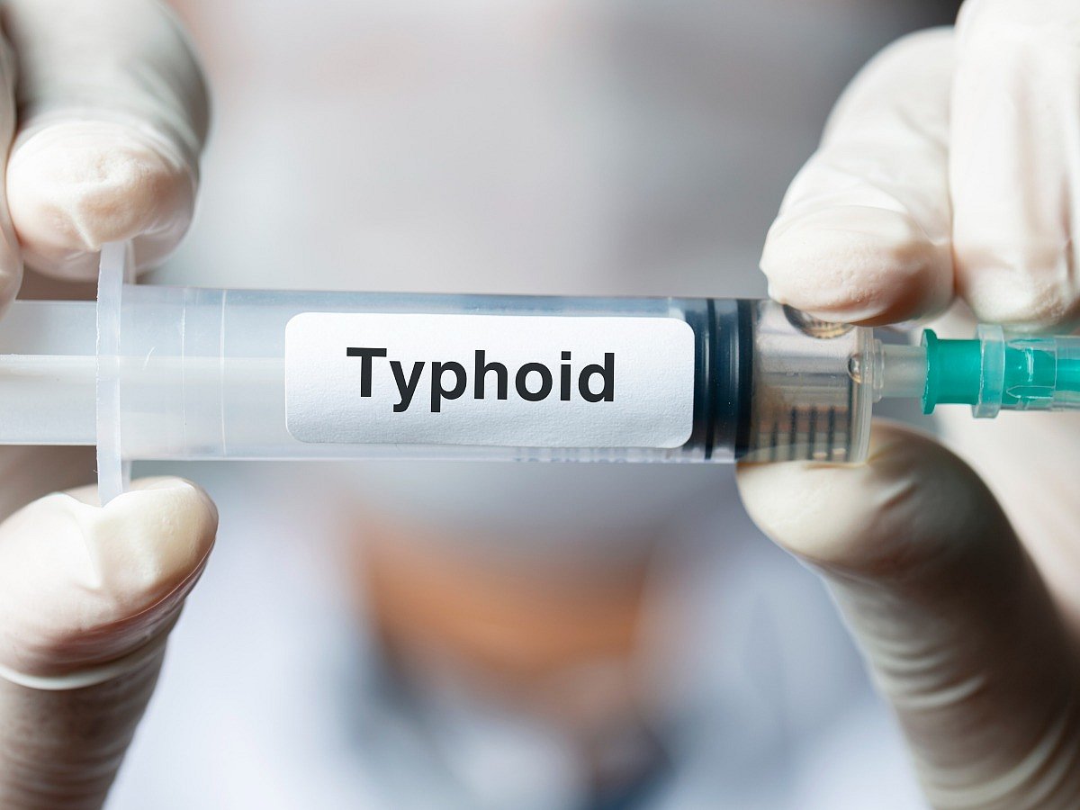 Typhoid Fever: Causes, Symptoms, Diagnosis, Treatment, and Management