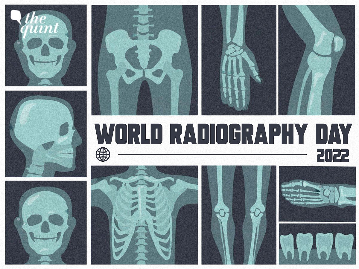 World Radiography Day 2022: Theme, History & Significance