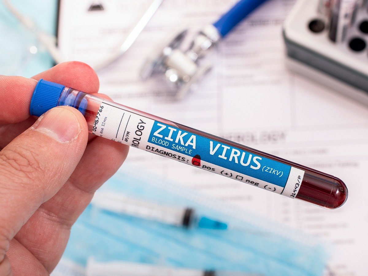 Zika Virus: Symptoms, Causes, Diagnosis, and Treatment