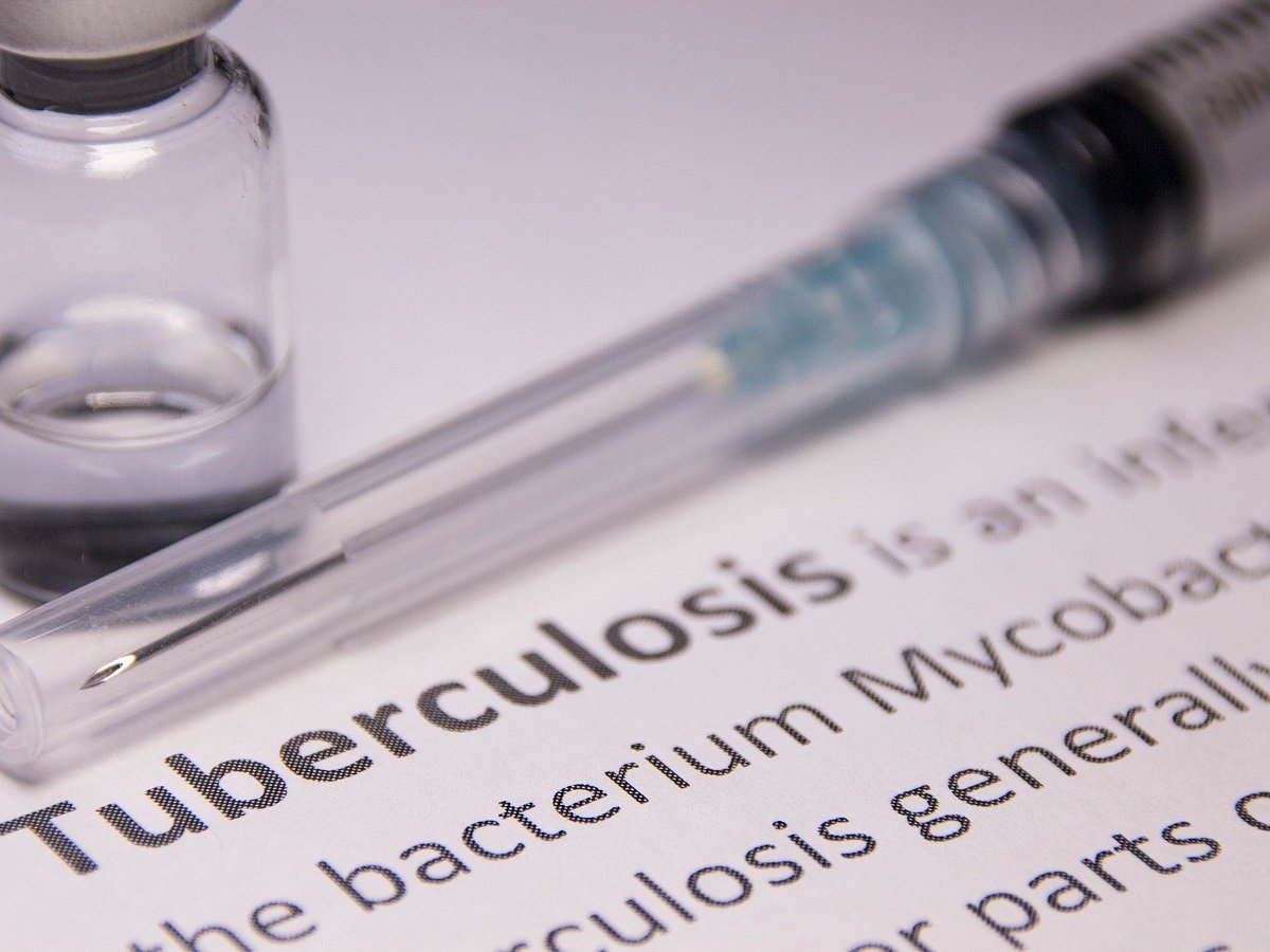 Busting Common Myths About Tuberculosis