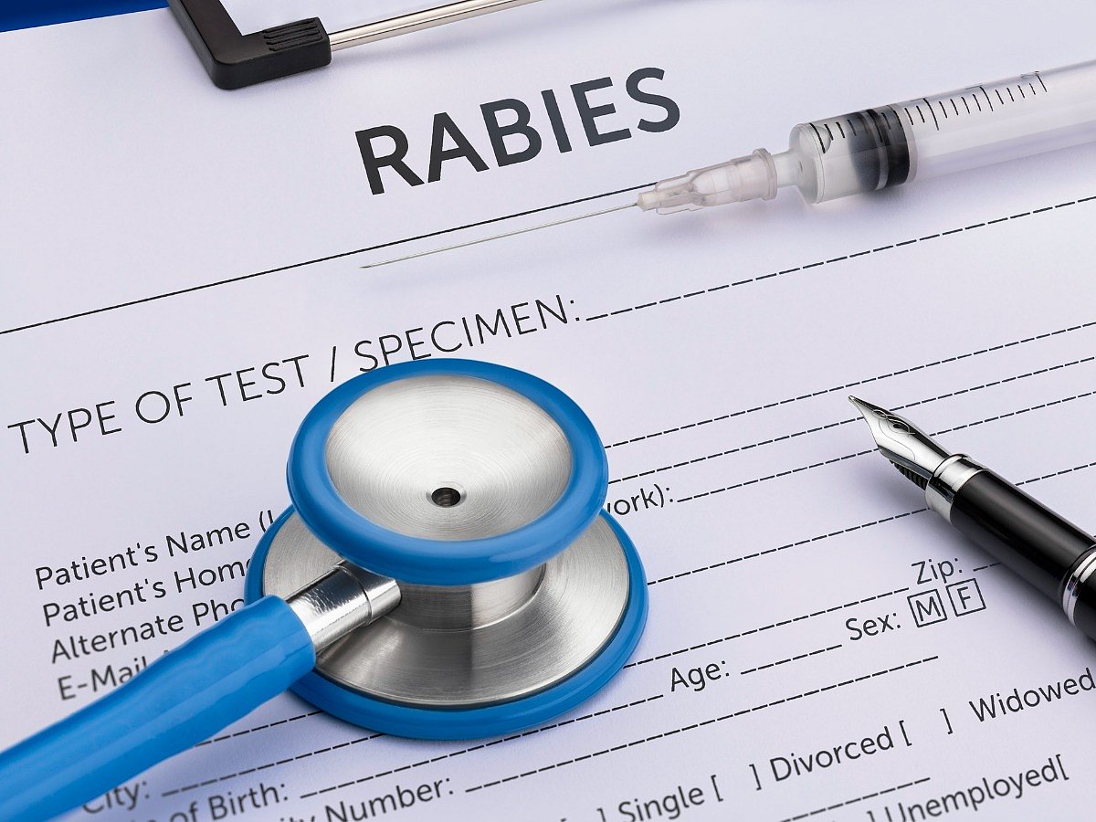 Rabies: Symptoms, Causes, Diagnosis & Treatment