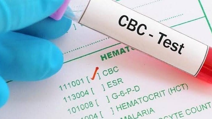 Understanding CBC Test Price and Importance in Blood Health