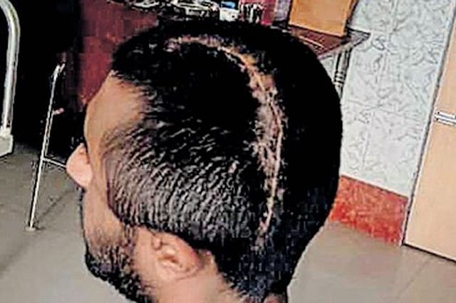 With no money to complete brain surgery, Kerala youth’s family seeks ...