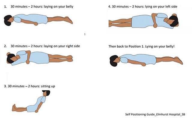 What is proning and how does it help improve COVID-19 patients' oxygen ...