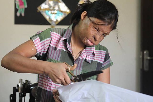 They stole her face, but her dreams are intact... Rupa an acid attack ...