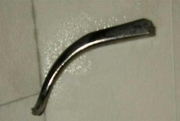 Surgical instrument left inside patient's abdomen in Thiruvananthapuram